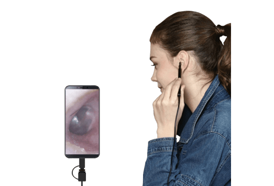 Ear Cleaning Spoon With Micro Camera, Easy Ear Cleaning With Camera ...